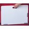 Standard Cardiac Board with Brackets | Armstrong Medical